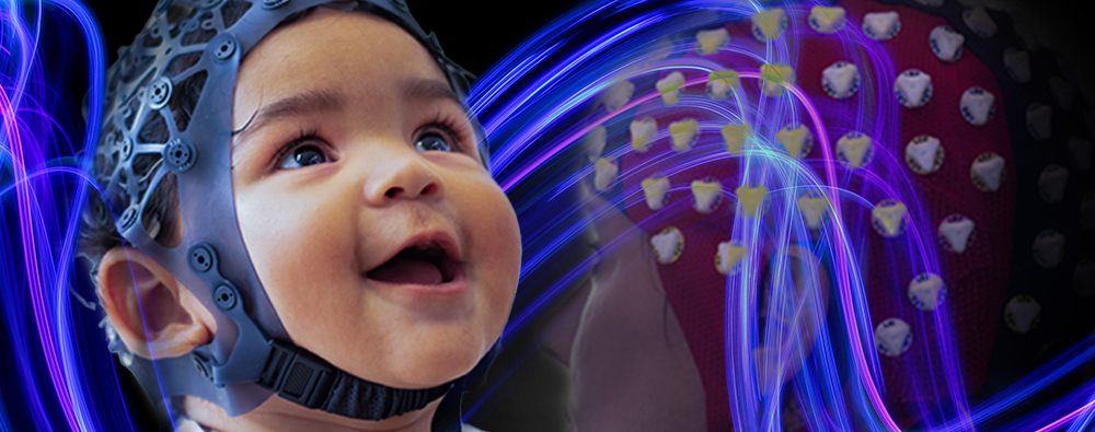 High-Density EEG (HD-EEG)