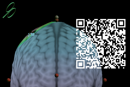 TMS Neuronavigation