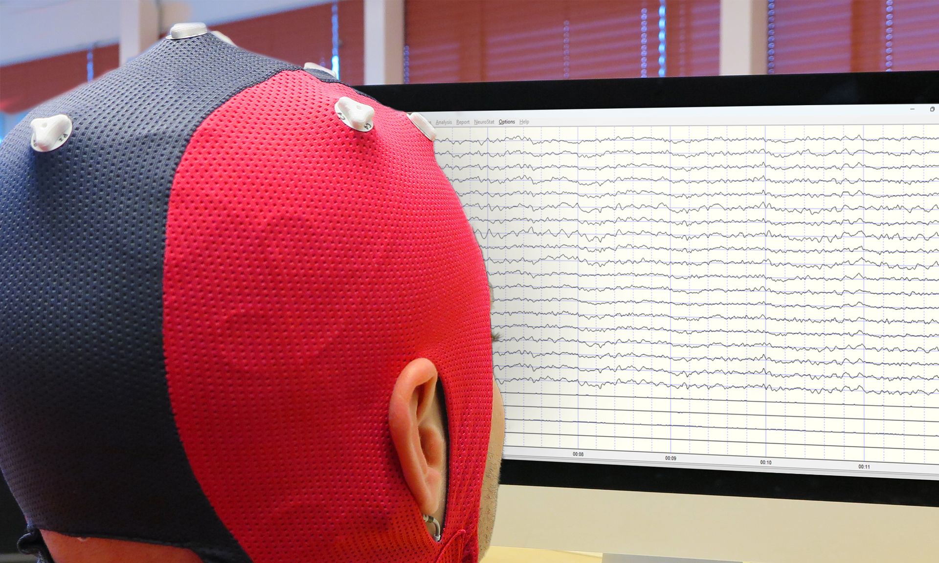 Rewire your brain through brain-maps based neurofeedback